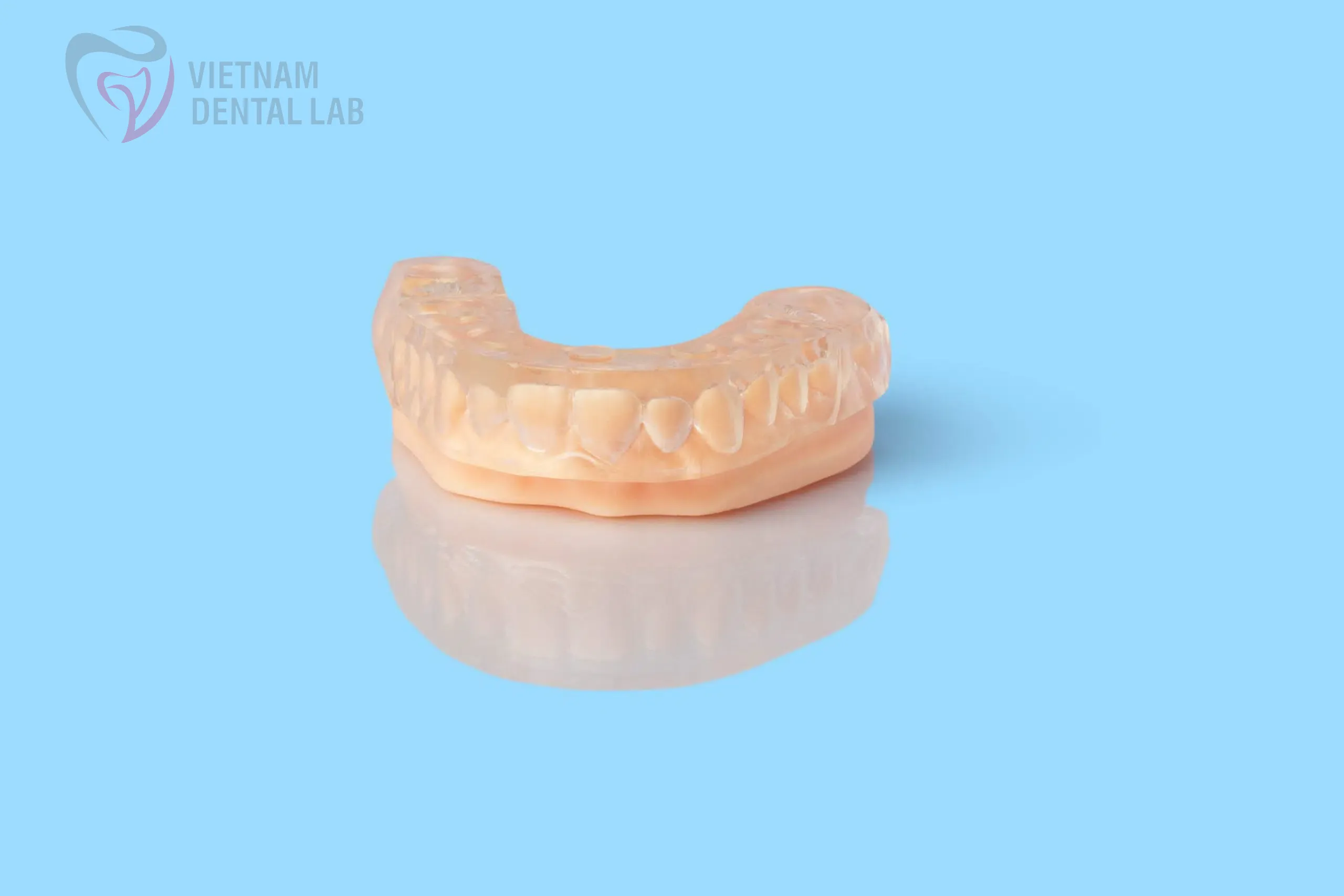 Injection moulding stent - Smile Design - Products | Vietnam Dental Lab